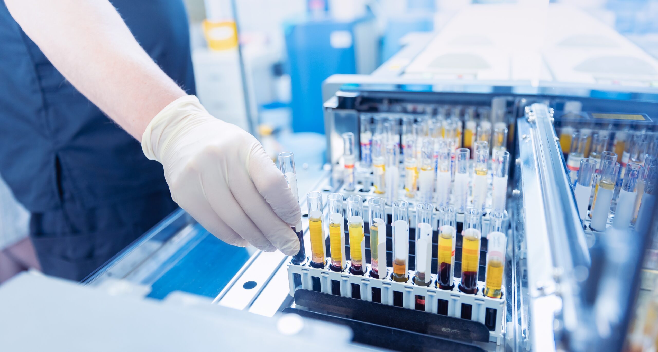 Bijkomende Laboratoriumanalyses bij Afwijkende Bloedstalen